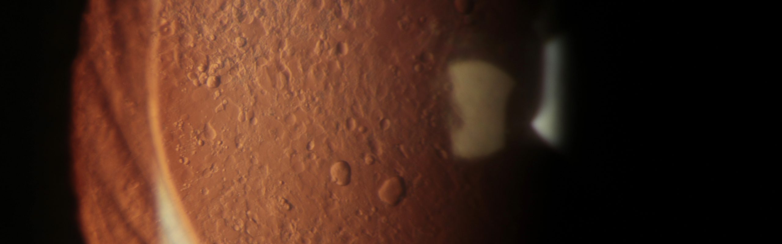 Stephen Comiskey, Senior Clinical Photographer - Royal Victoria Eye and ...